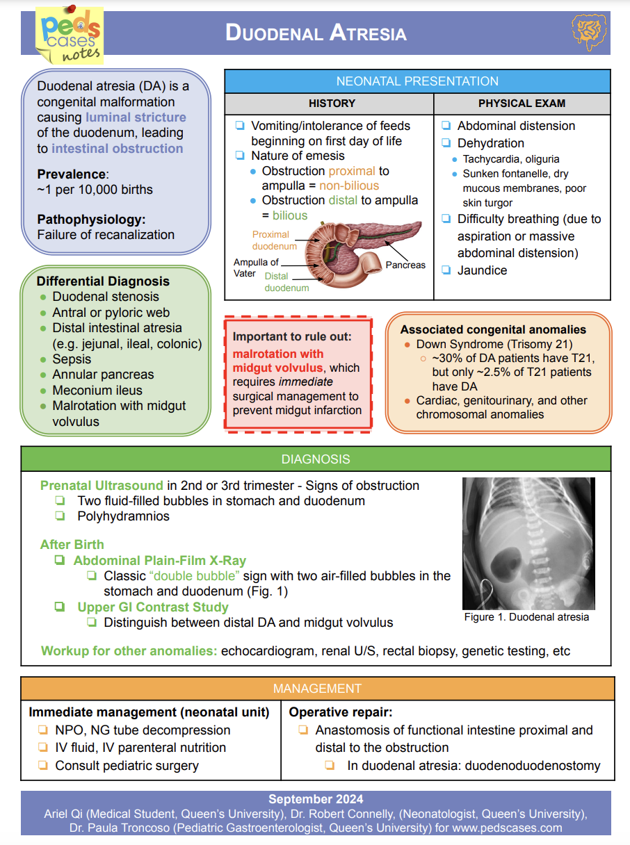 Duodenal Atresia | PedsCases